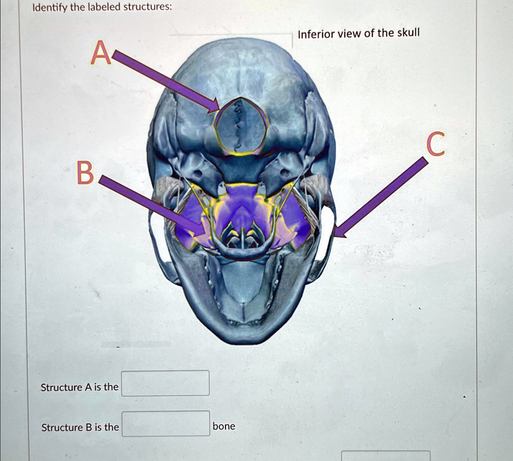 Identify the labeled structures: Structure A is the Structure B is the ...