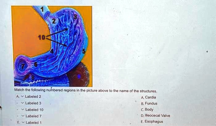 Match the following numbered regions in the picture above to the name of the structures. A ...