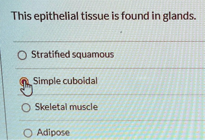 SOLVED: This epithelial tissue is found in glands. Stratified squamous ...