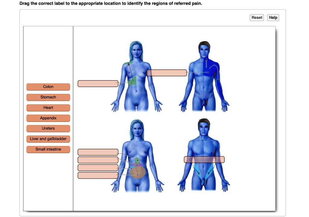 SOLVED: Drag the correct label to the appropriate location to identify the regions of referred ...