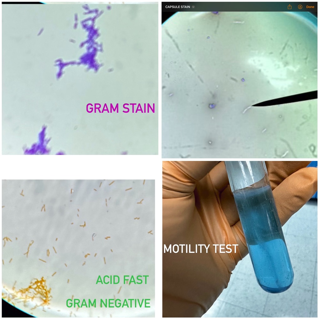 CAPSULE STAIN GRAM STAIN MOTILITY TEST ACID FAST GRAM NEGATIVE