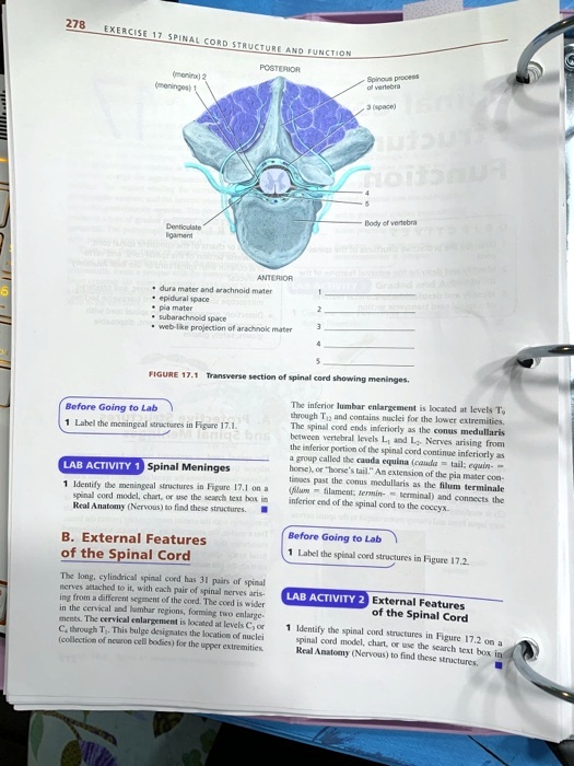 SOLVED: (moninx)2 (meninges) POSTERIOR inous proc of vertebra Denticulatt ligament Body of ...