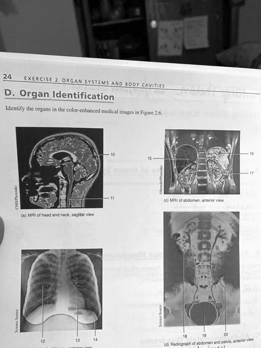 Science Source CNRI/Phototake 24 EXERCISE 2 ORGAN SYSTEMS AND BODY ...