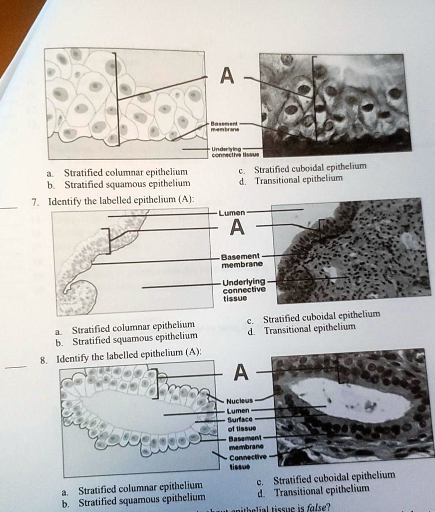 basement membrane underlying connective tissue stratified cuboidal ...