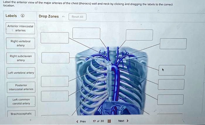 Label the anterior view of the major arteries of the chest (thoracic ...