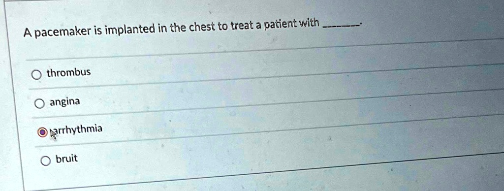 A pacemaker is implanted in the chest to treat a patient with ...