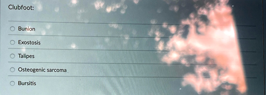 Clubfoot: ? Bunion ? Exostosis ? Talipes ? Osteogenic sarcoma ? Bursitis