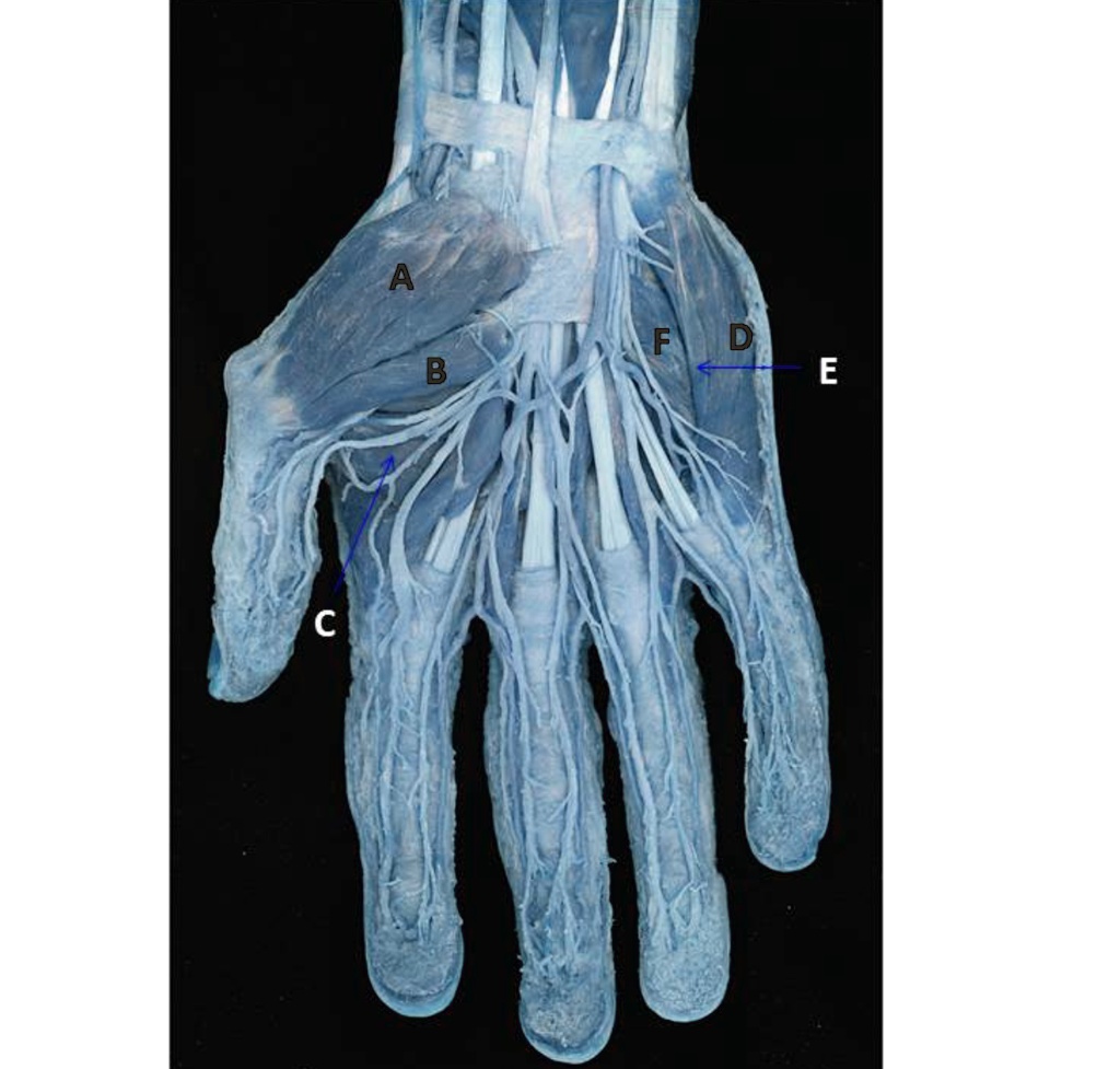 identify and name the following muscles of the thenar and hypothenar ...