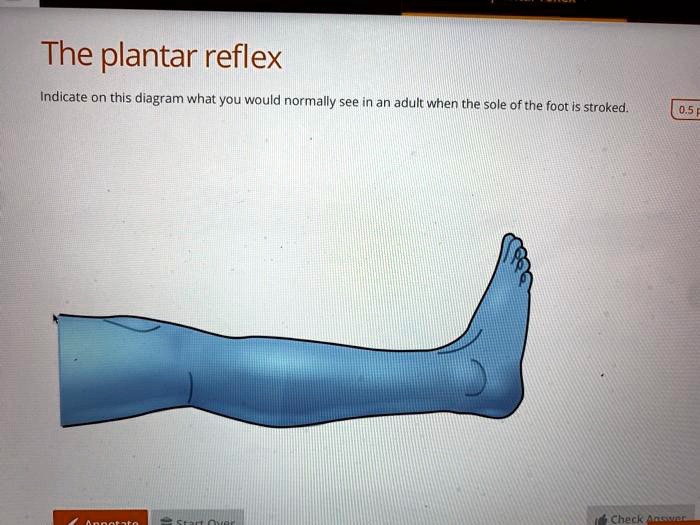 the plantar reflex indicate on this diagram what you would normally see ...
