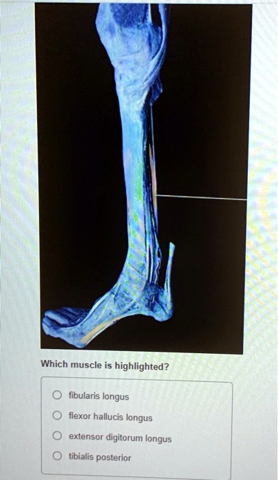 [GET ANSWER] Which muscle is highlighted? fibularis longus flexor ...