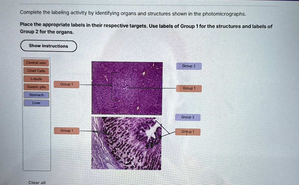 complete the labeling activity by identifying organs and structures ...