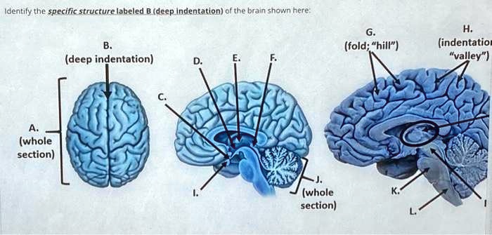 Identify the specific structure labeled B (deep indentation) of the ...