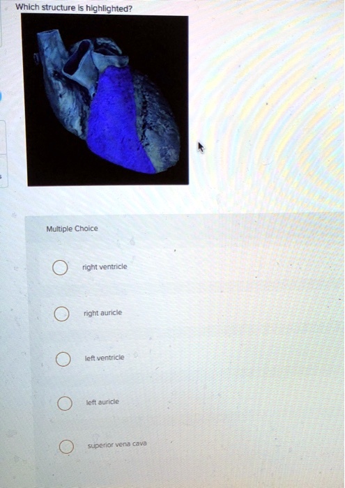SOLVED: Which structure is highlighted? Multiple Choice right ventricle ...