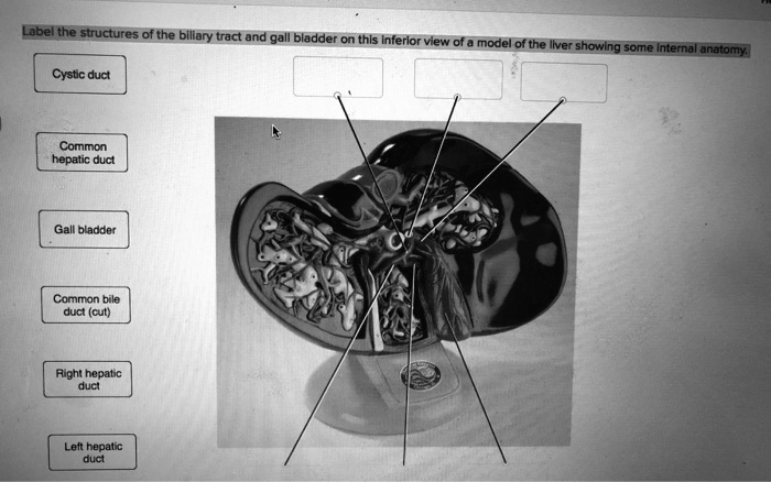 SOLVED: Label the structures of the biliary tract and gallbladder on ...