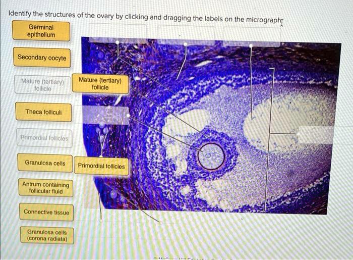 Identify the structures of the ovary by clicking and dragging the ...