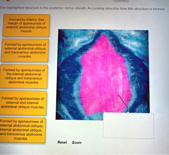 SOLVED: The highlighted structure is the posterior rectus sheath ...