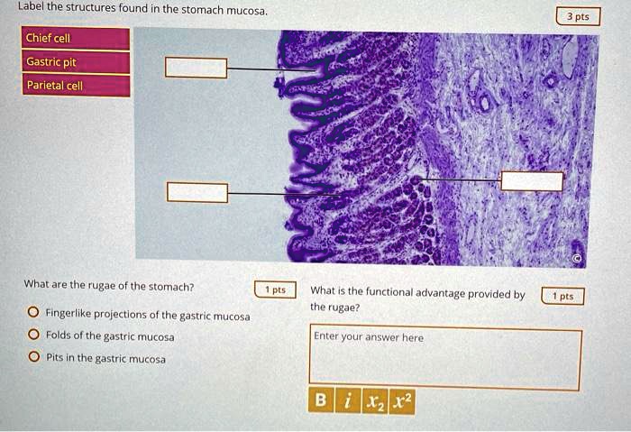 SOLVED: Label the structures found in the stomach mucosa. 3 pts Chief ...