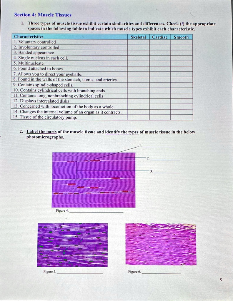 Section 4: Muscle Tissues 1. Three types of muscle tissue exhibit ...