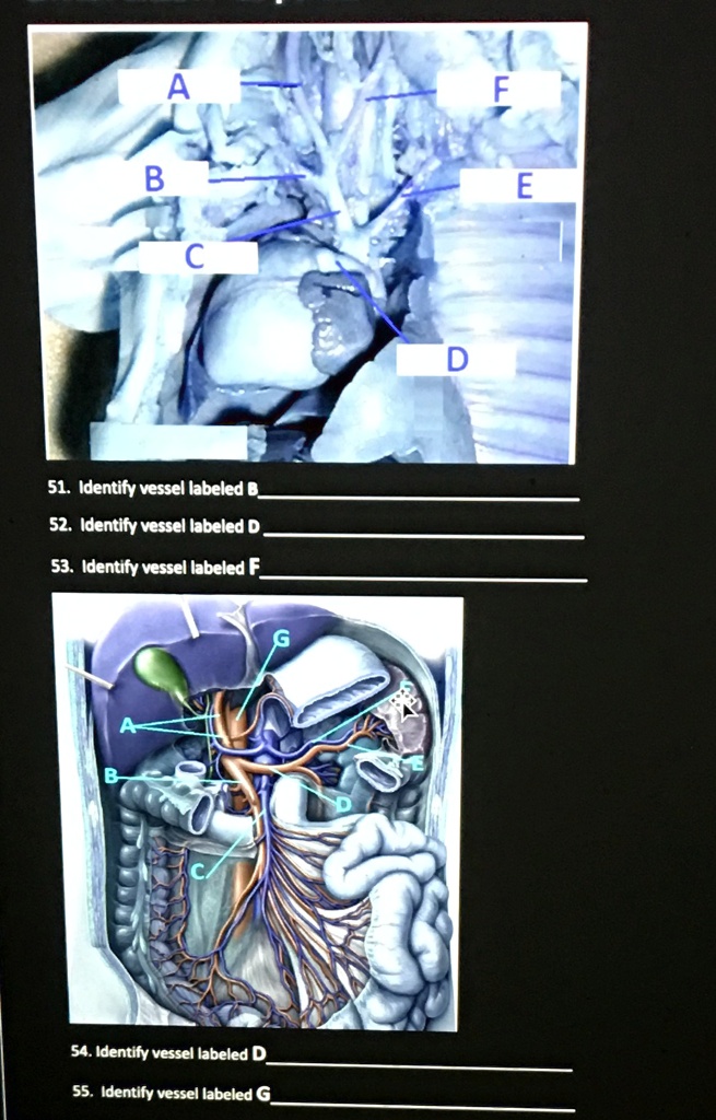 SOLVED: 'Identify vessels unless instructed something different. D 0 51 ... SOLVED: 'Identify vessels unless instructed something different. D 0 51 ...