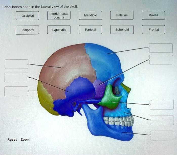 Label bones seen in the lateral view of the skull. Occipital Inferior ...