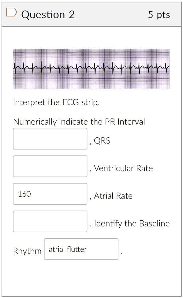 question 2 5 pts interpret the ecg strip numerically indicate the pr ...
