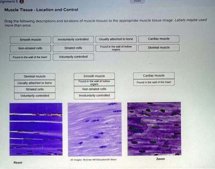SOLVED: Muscle Tissue - Location and Control Drag the following descriptions and locations of ...