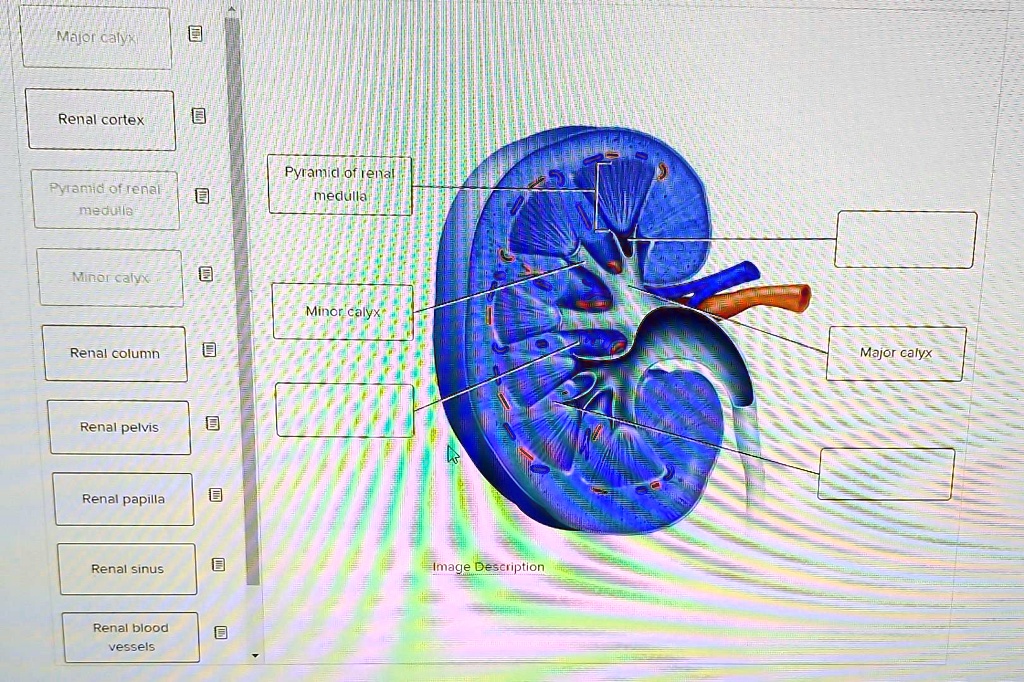 [GET ANSWER] Major calyx Renal cortex Pyramid of renal medulla Minor calyx Renal column Renal ...
