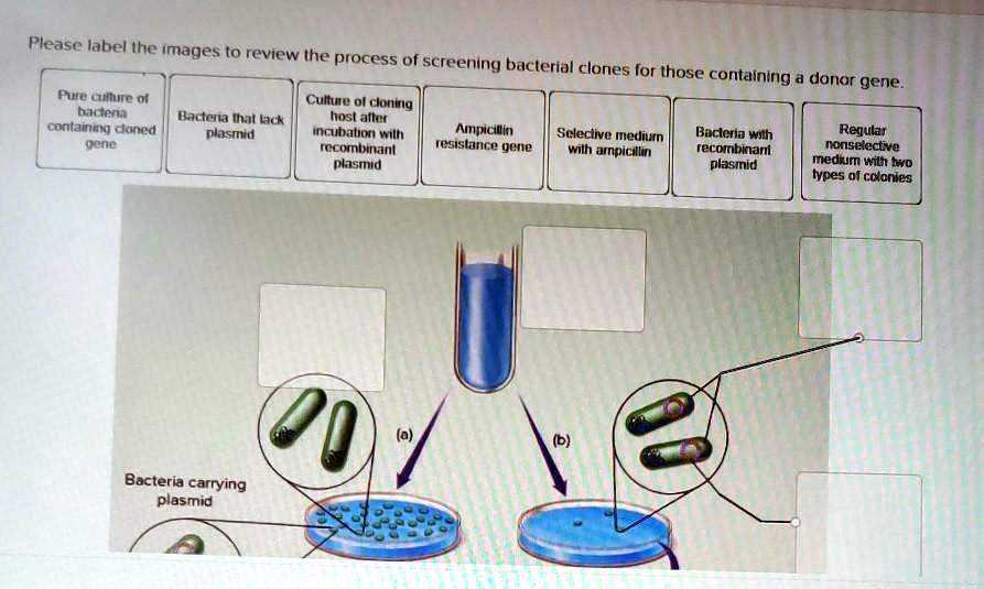 Please label the images to review the process of screening bacterial ...