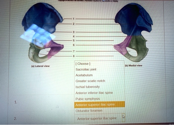 SOLVED: 4 6 7 [Choose] Sacroiliac joint (a) Lateral view (b) Medial view Acetabulum Greater ...