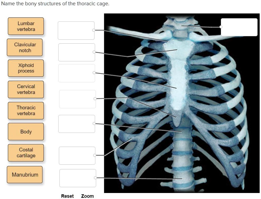 SOLVED: Name the bony structures of the thoracic cage Lumbar vertebra ... SOLVED: Name the bony structures of the thoracic cage Lumbar vertebra ...