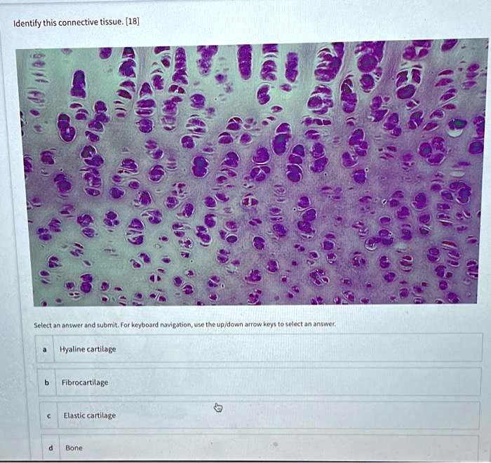 SOLVED: Identify this connective tissue.[18] Select an answer and submit. For keyboard ...