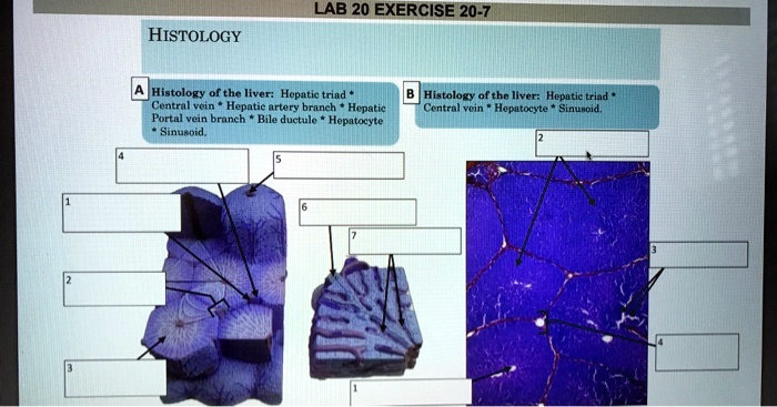 LAB 20 EXERCISE 20-7 HISTOLOGY A Histology of the liver: Hepatic triad ...