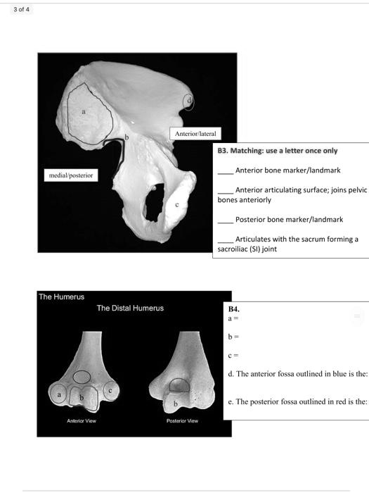 SOLVED: Anterior/lateral B3. Matching: use a letter once only medial ...