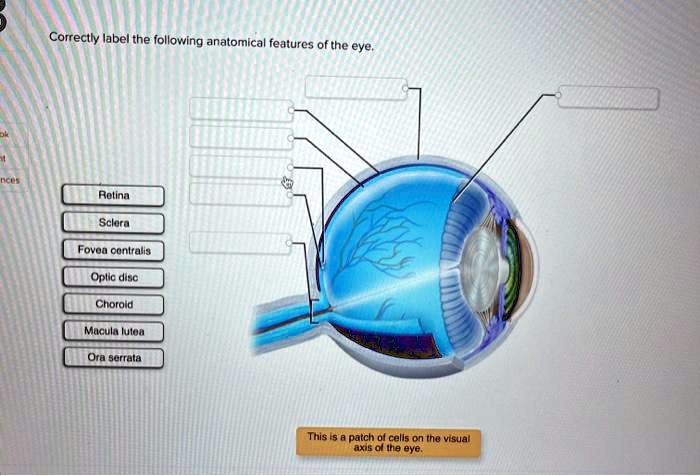 SOLVED: Correctly label the following anatomical features of the eye: - Retina - Sclera - Fovea ...
