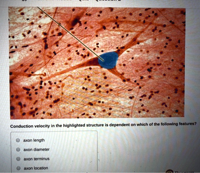 conduction velocity in the highlighted structure is dependent on which of the following features ...