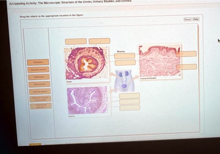 Art-labeling Activity: The Microscopic Structure of the Ureter, Urinary ...