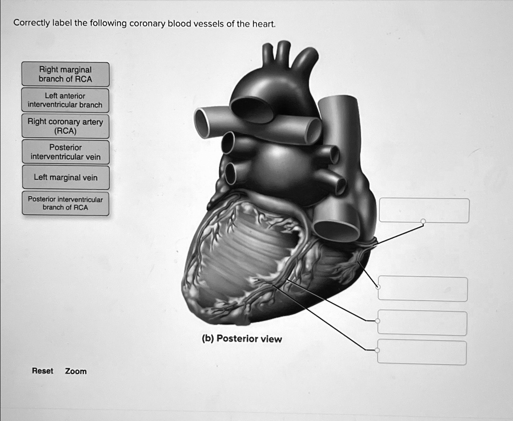 Correctly label the following coronary blood vessels of the heart ...