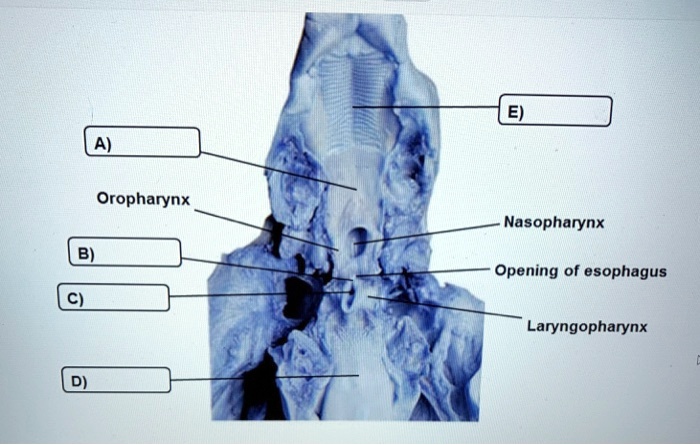 SOLVED: Label the parts of the oral cavity on the fetal pig A ...