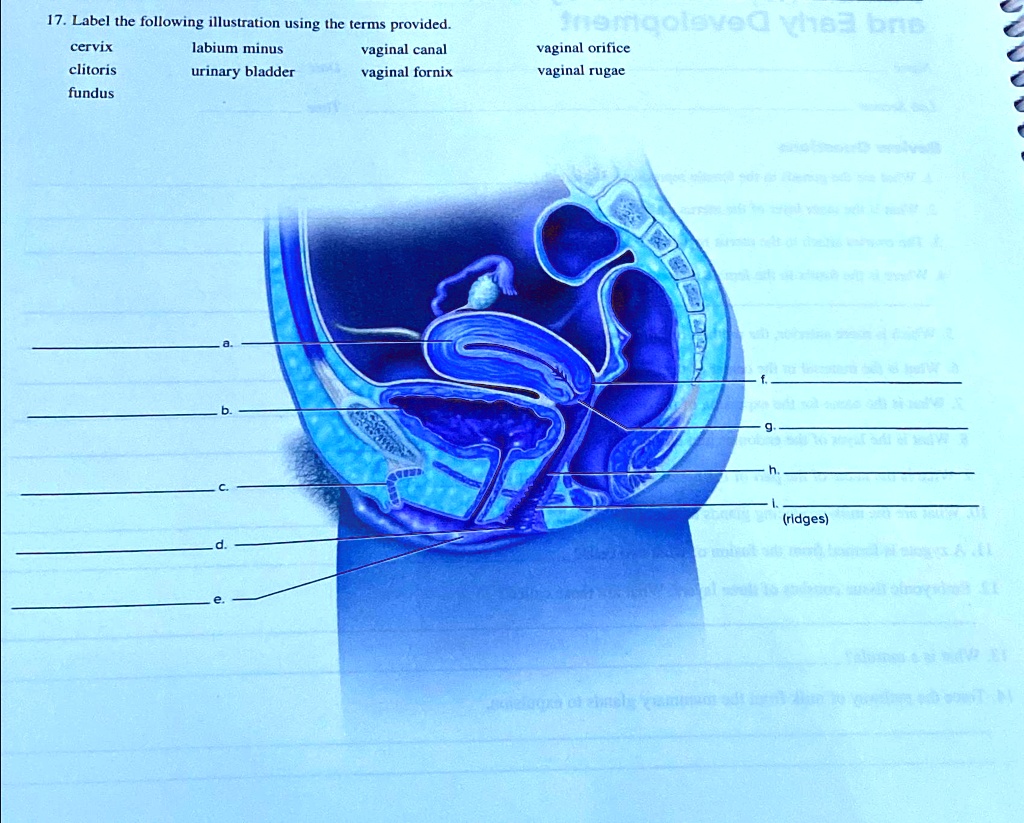 SOLVED: Label the following illustration using the terms provided ...
