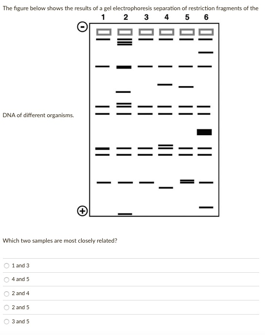 the figure below shows the results of a gel electrophoresis separation ...