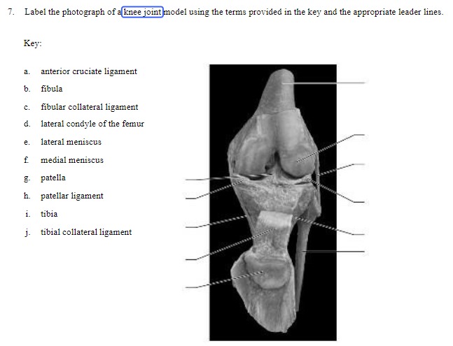 SOLVED: Label the photograph of a(knee joint)model using the terms provided in the key and the ...