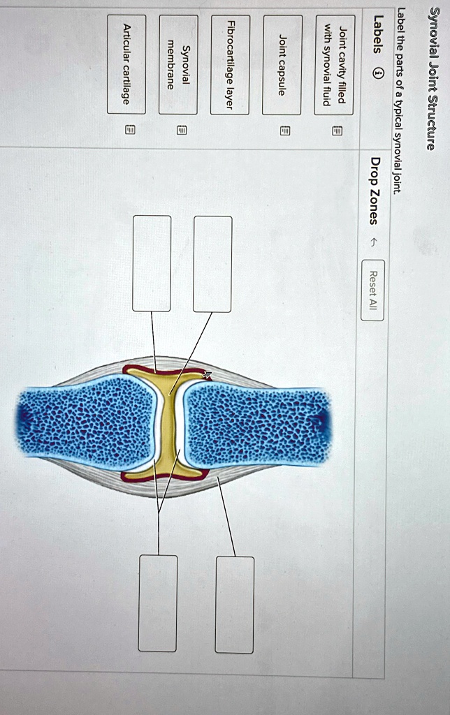 SOLVED: Synovial Joint Structure Label the parts of a typical synovial joint. able[[Labels (i ...