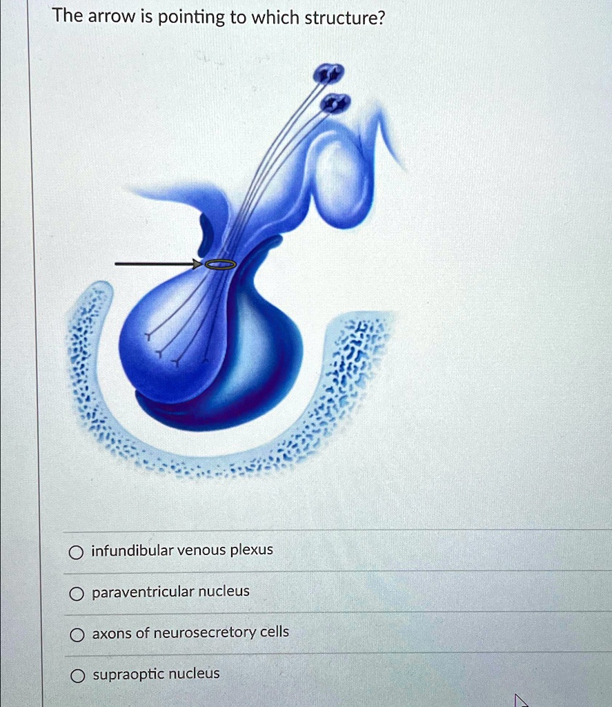 the arrow is pointing to which structure infundibular venous plexus ...