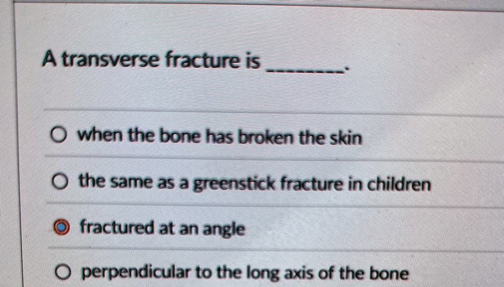 A transverse fracture is O when the bone has broken the skin O the same ...