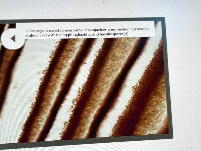 SOLVED: Insert your saved screenshot/softheAgaricus cross section ...