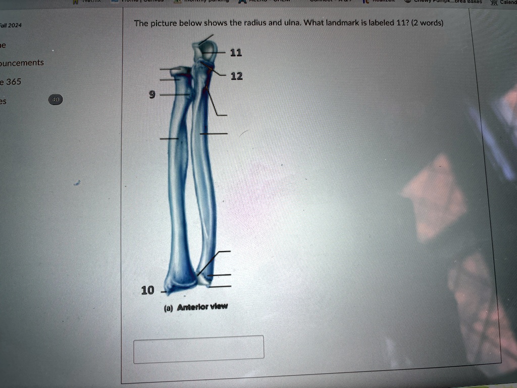 The picture below shows the radius and ulna. What landmark is labeled ...