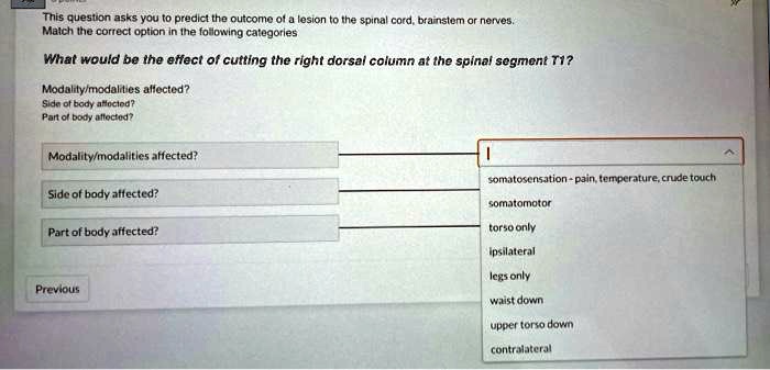 This question asks you to predict the outcome of a lesion to the spinal ...
