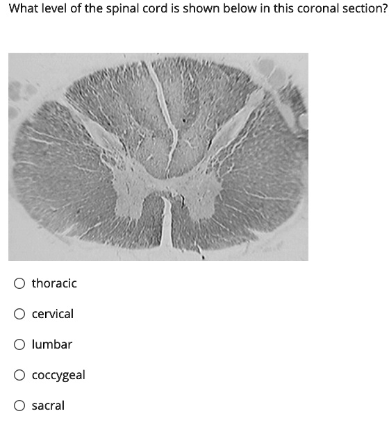 What level of the spinal cord is shown below in this coronal...