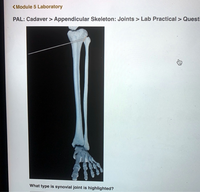 SOLVED: Module 5 Laboratory: Cadaver - Appendicular Skeleton: Joints ...