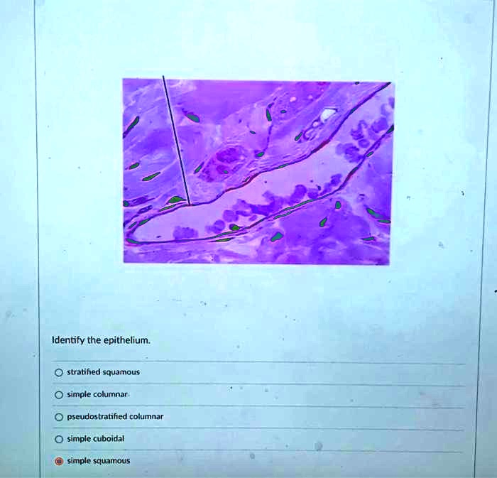 SOLVED: Texts: Identify the epithelium. - Stratified squamous - Simple ...